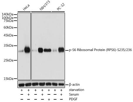 Phospho-S6 Ribosomal Protein (RPS6)-S235/236 Rabbit pAb (AMR00975N)