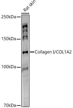 Collagen I/COL1A2 Rabbit mAb (AMR11253N)