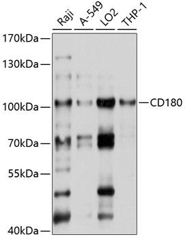 CD180 Rabbit pAb (APR17847N)