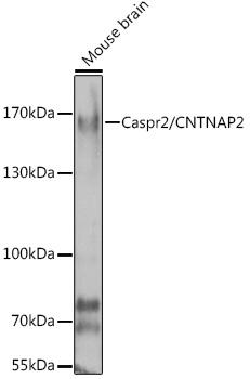 Caspr2/CNTNAP2 Rabbit pAb (APR27418N)