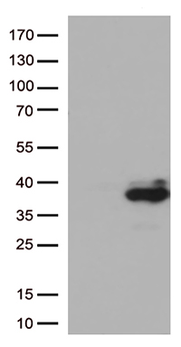 Major Basic Protein (PRG2) Mouse Monoclonal Antibody [Clone ID: LBI1C12]