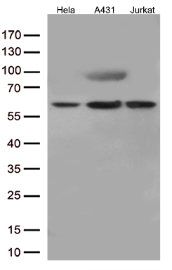 JNK3 (MAPK10) Mouse Monoclonal Antibody [Clone ID: LBI2H6]